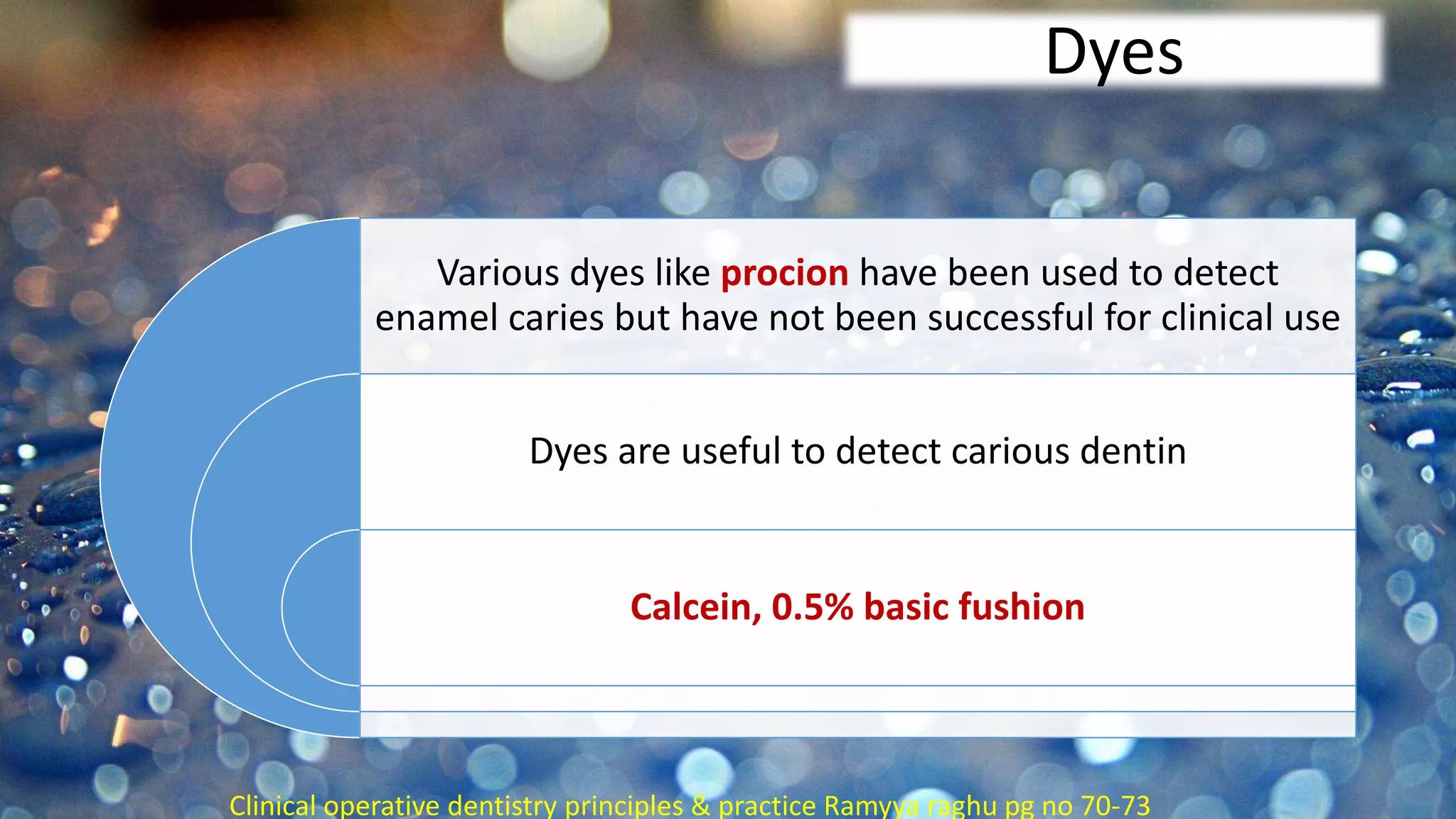 Diagnosis & treatment of Dental caries | PPTX
