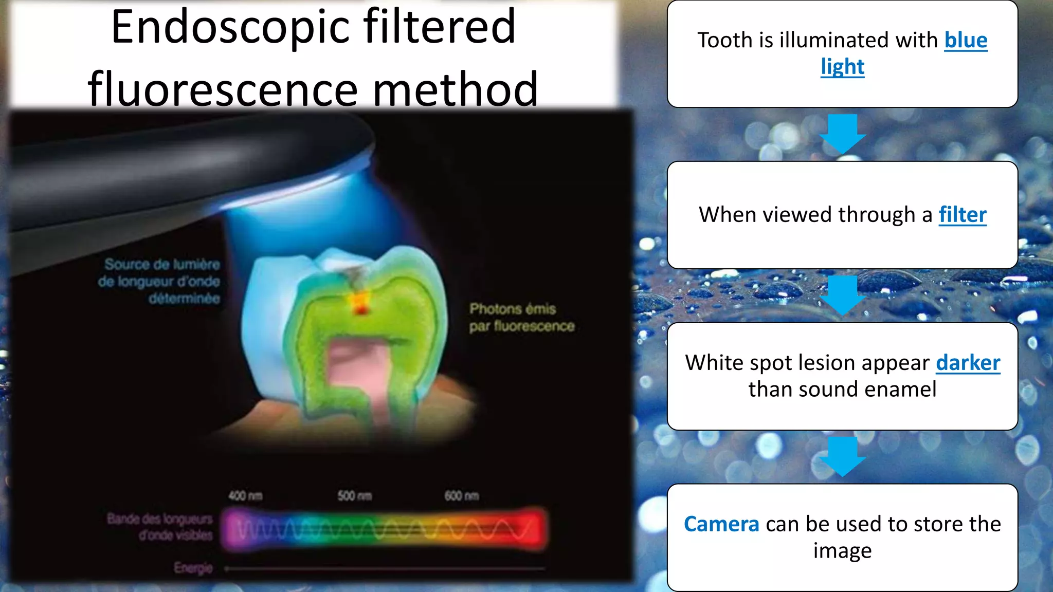 Diagnosis & treatment of Dental caries | PPTX