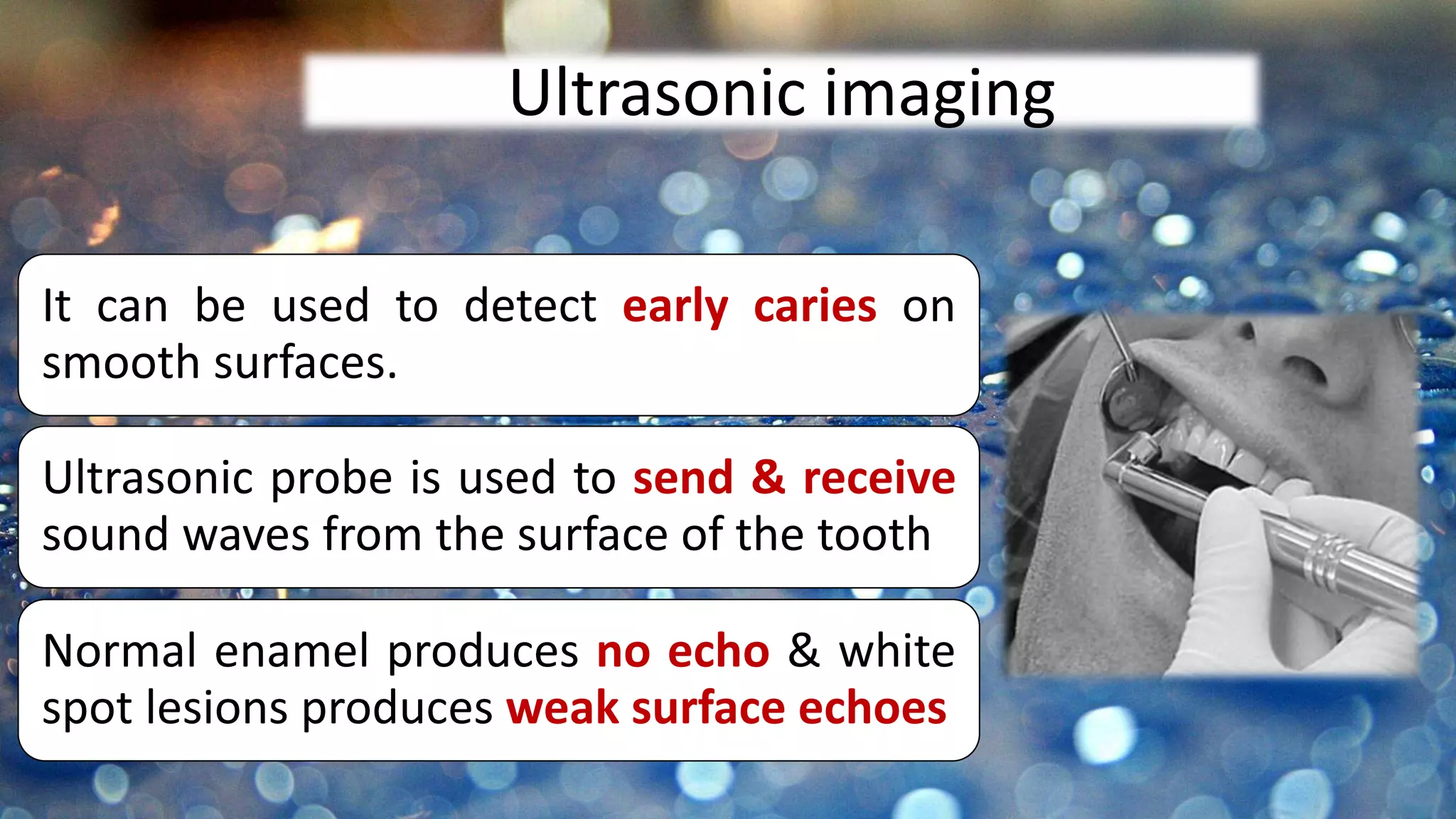 Diagnosis & treatment of Dental caries | PPTX