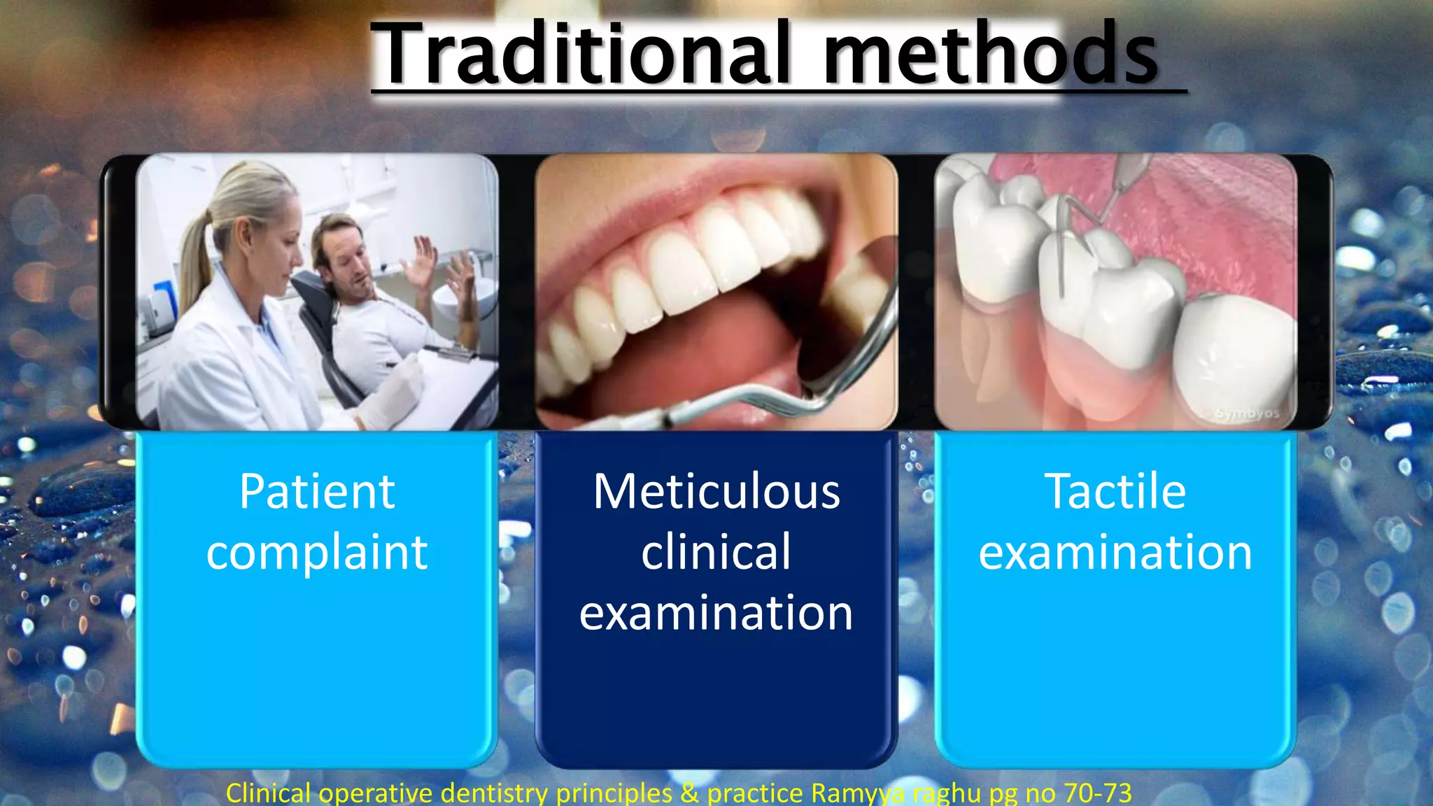 Diagnosis & treatment of Dental caries | PPTX