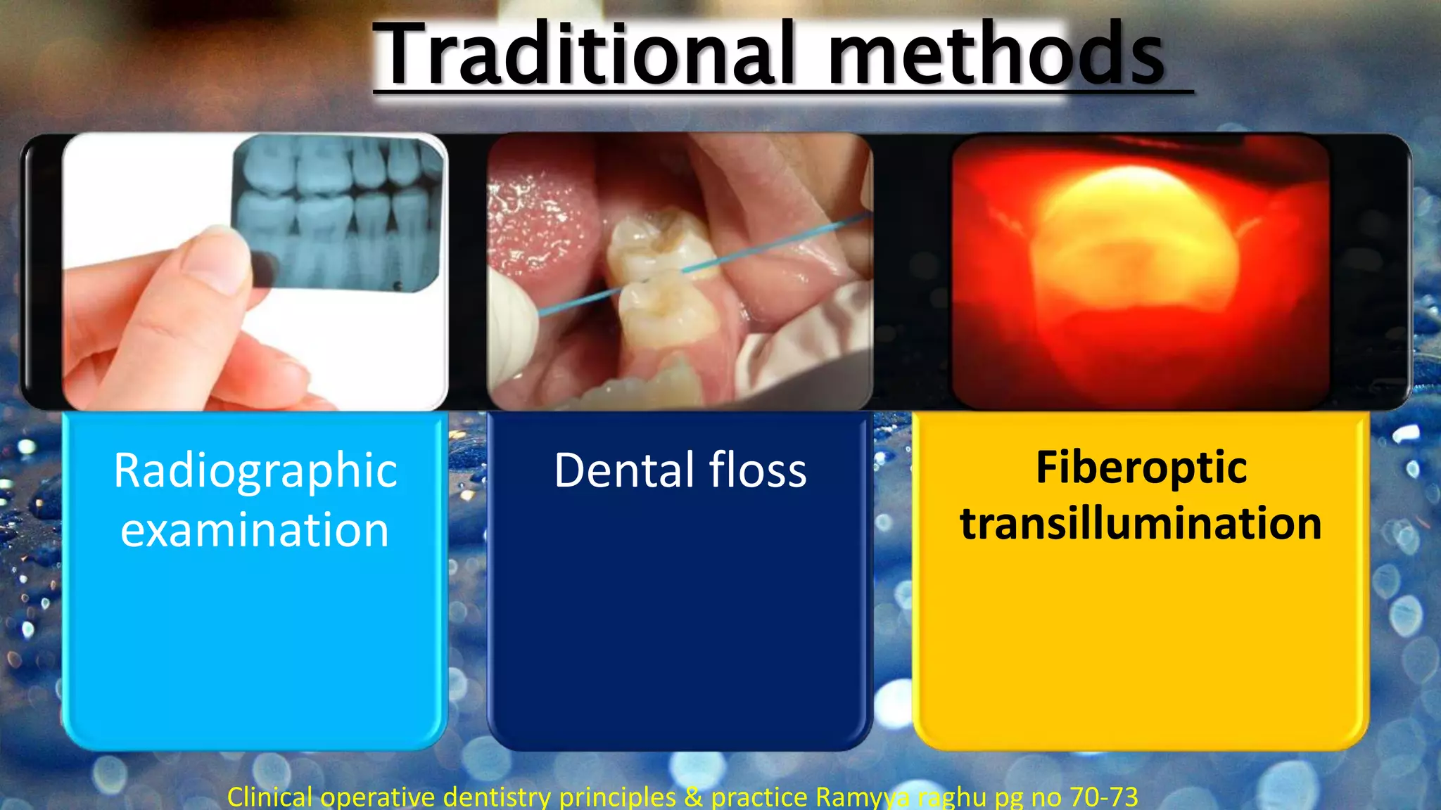 Diagnosis & treatment of Dental caries | PPTX