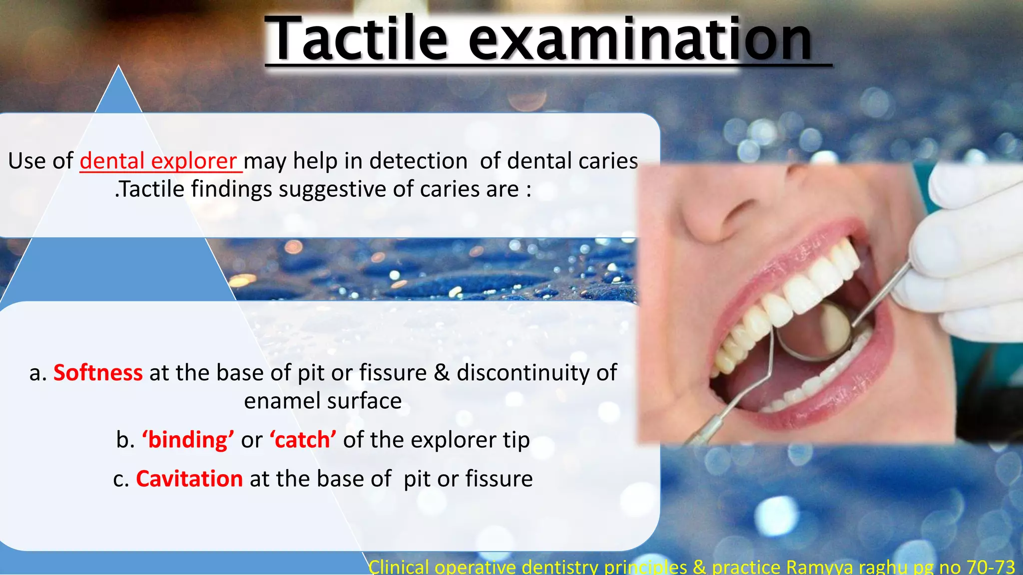 Diagnosis & treatment of Dental caries | PPTX