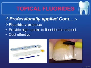 Prevention of dental caries | PPT