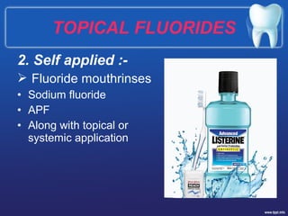 Prevention of dental caries | PPT