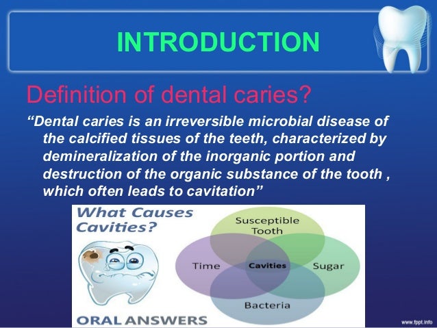 Karies Causes Symptoms Treatment Karies