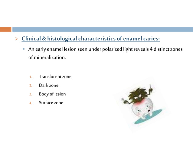 Dental caries ppt | PPTX