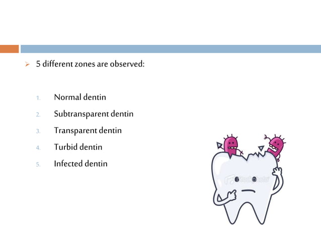 Dental caries ppt