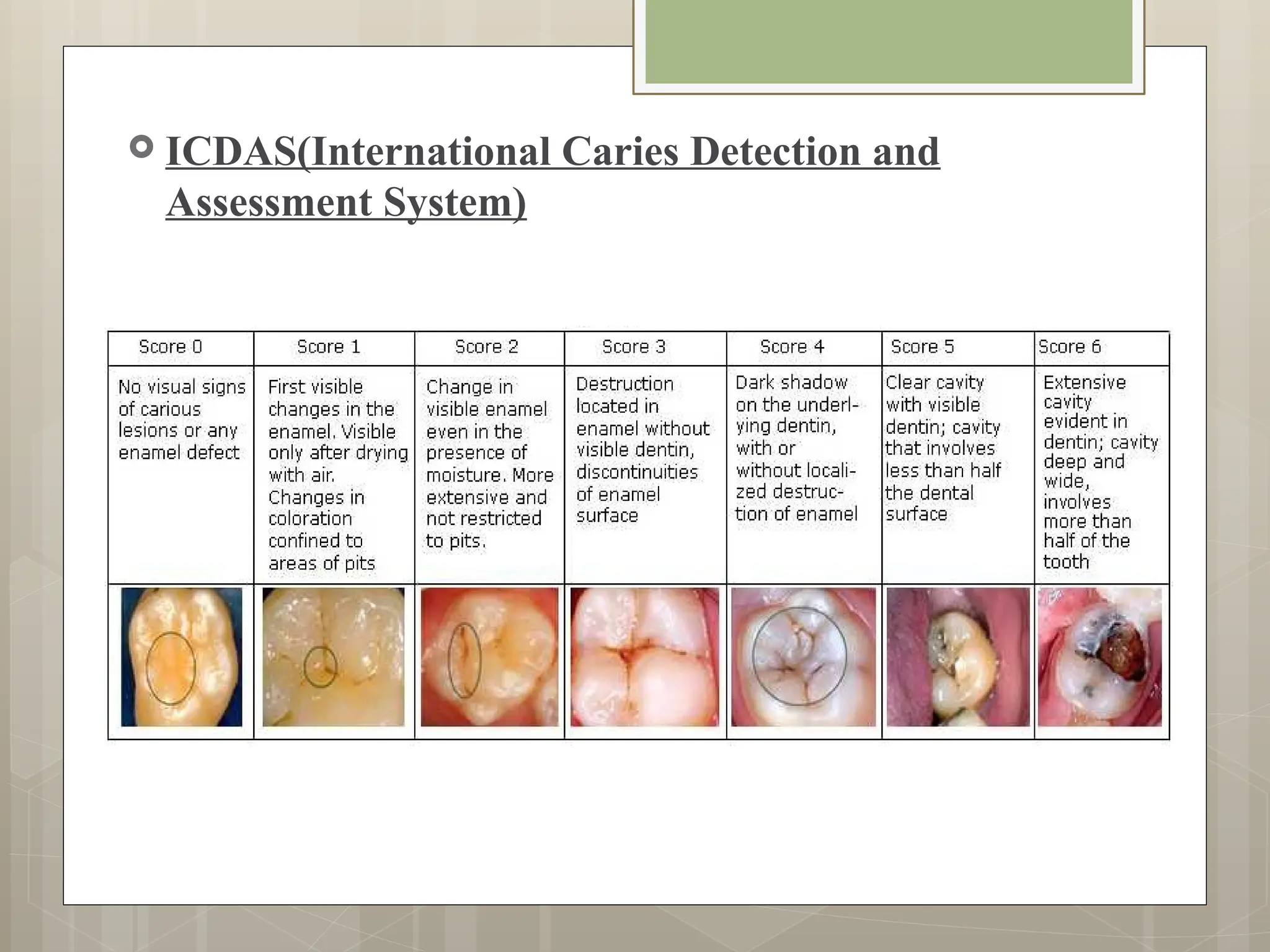 dental caries ,recent advances,prevention,treatment | PPTX