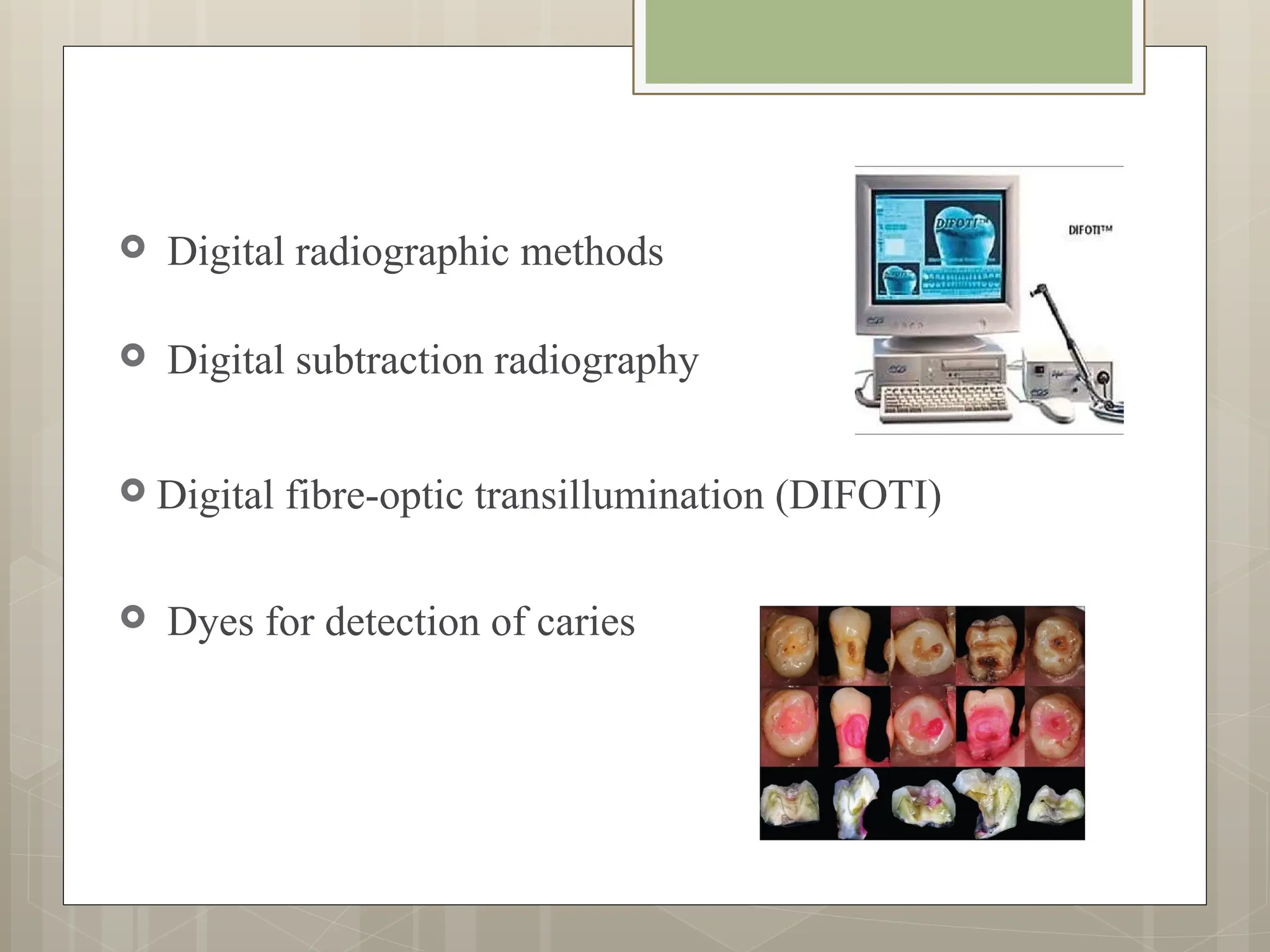 dental caries ,recent advances,prevention,treatment | PPTX
