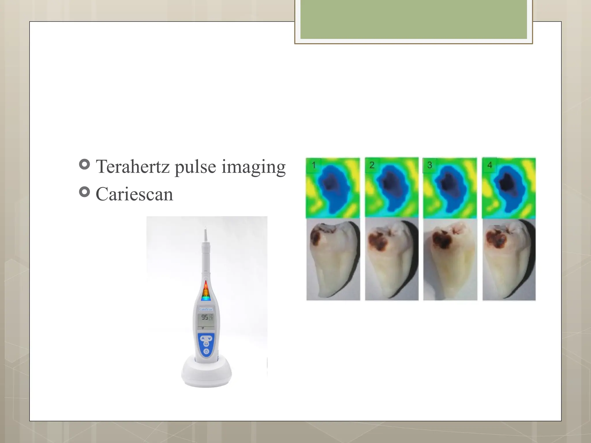 dental caries ,recent advances,prevention,treatment | PPTX