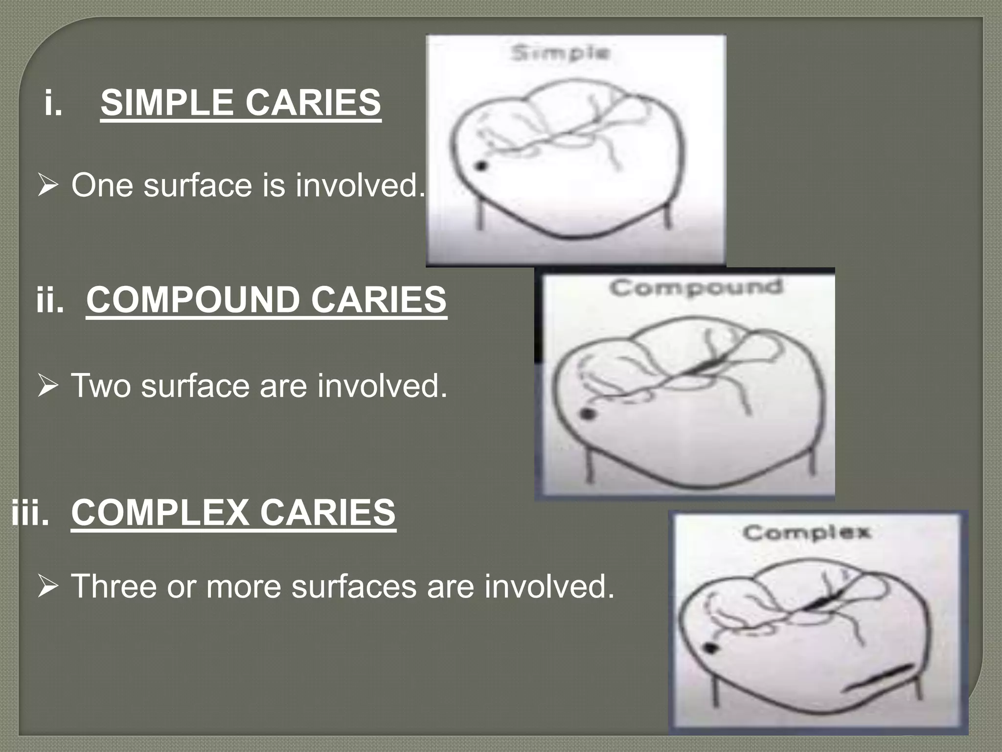 Dental caries (operative dentistry) | PPTX