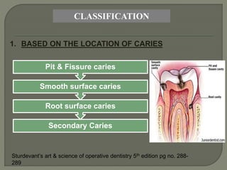 Dental caries (operative dentistry) | PPTX