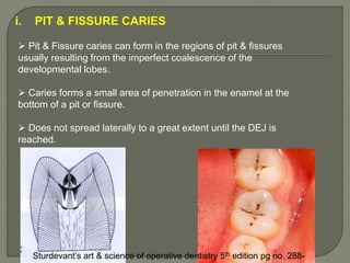 Dental caries (operative dentistry) | PPTX