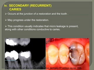 Dental caries (operative dentistry) | PPT