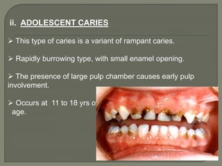 Dental caries (operative dentistry) | PPT
