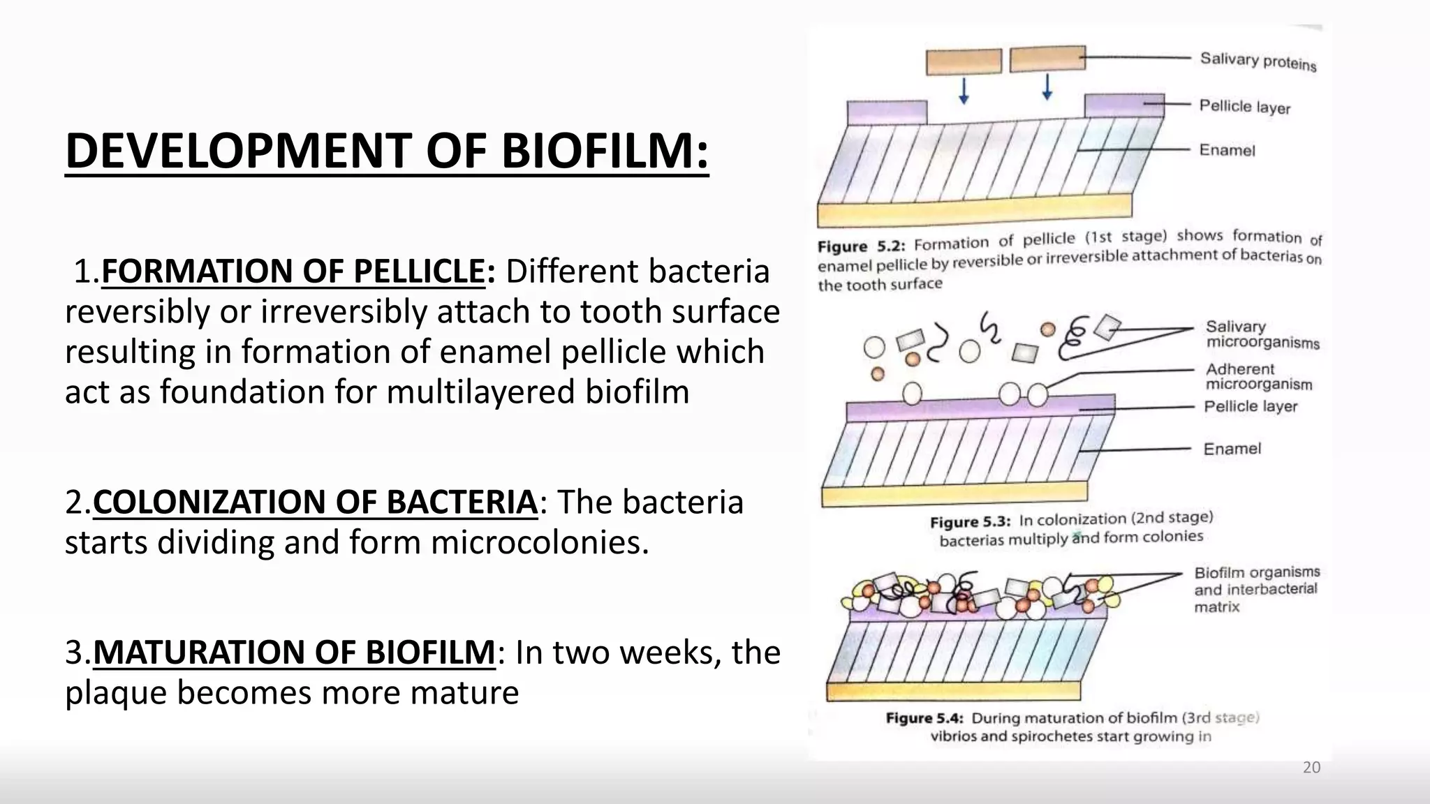 Dental caries etiology, theories and prevention | PPTX