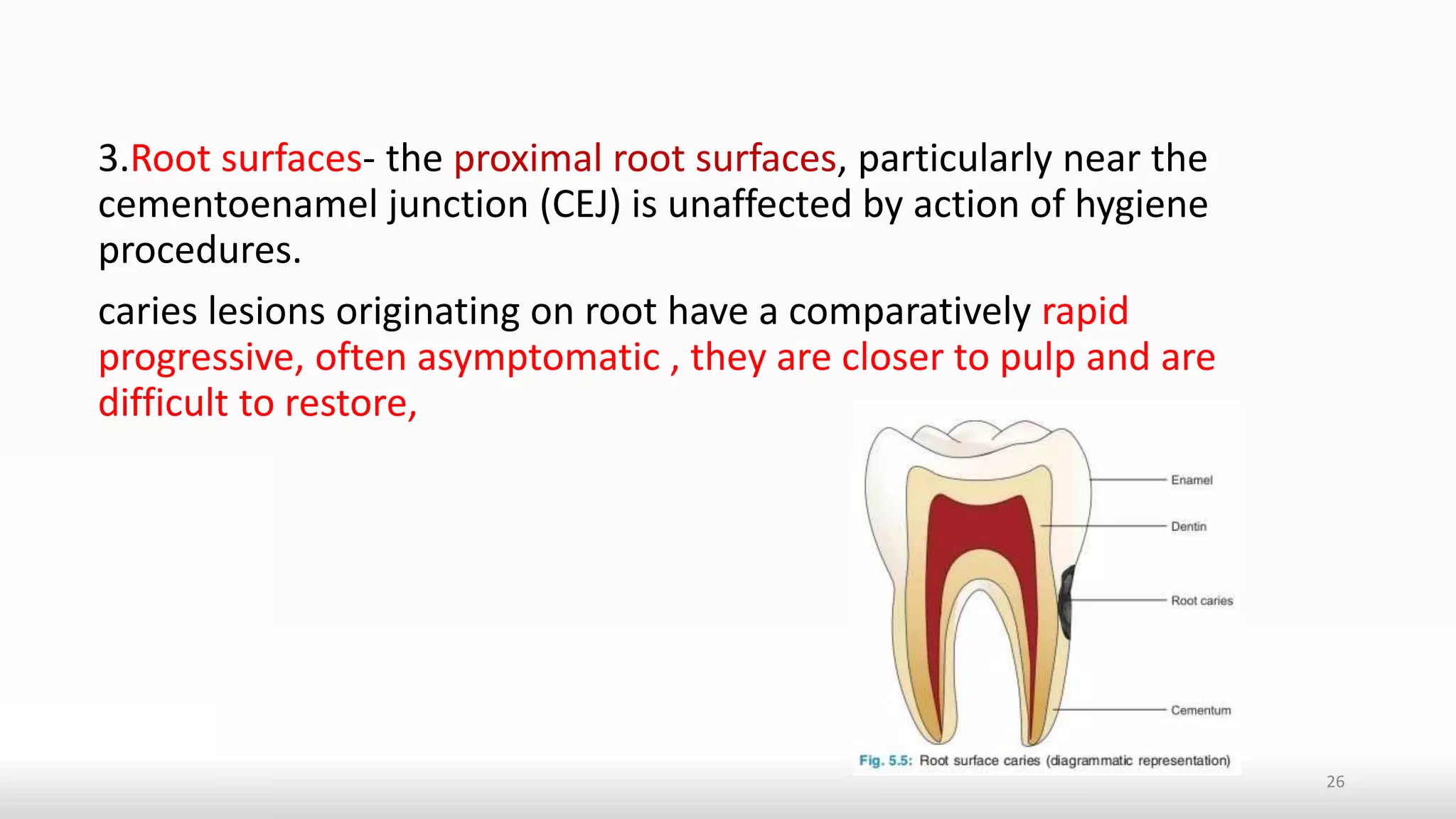 Dental caries etiology, theories and prevention | PPTX