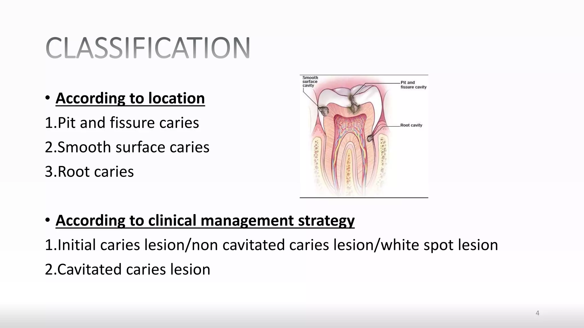Dental caries etiology, theories and prevention | PPTX