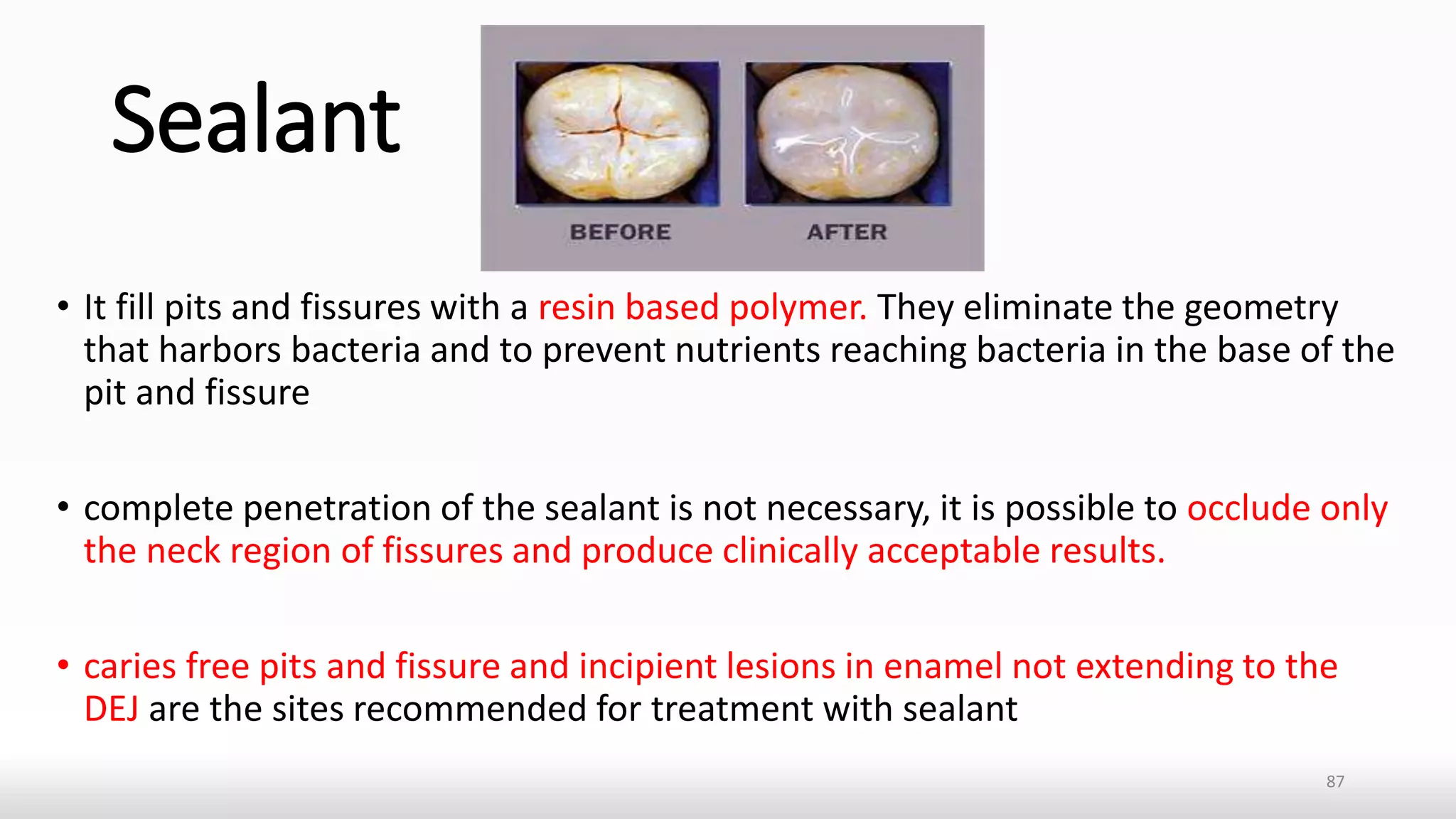 Dental caries etiology, theories and prevention | PPTX