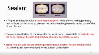 Dental caries etiology, theories and prevention | PPTX