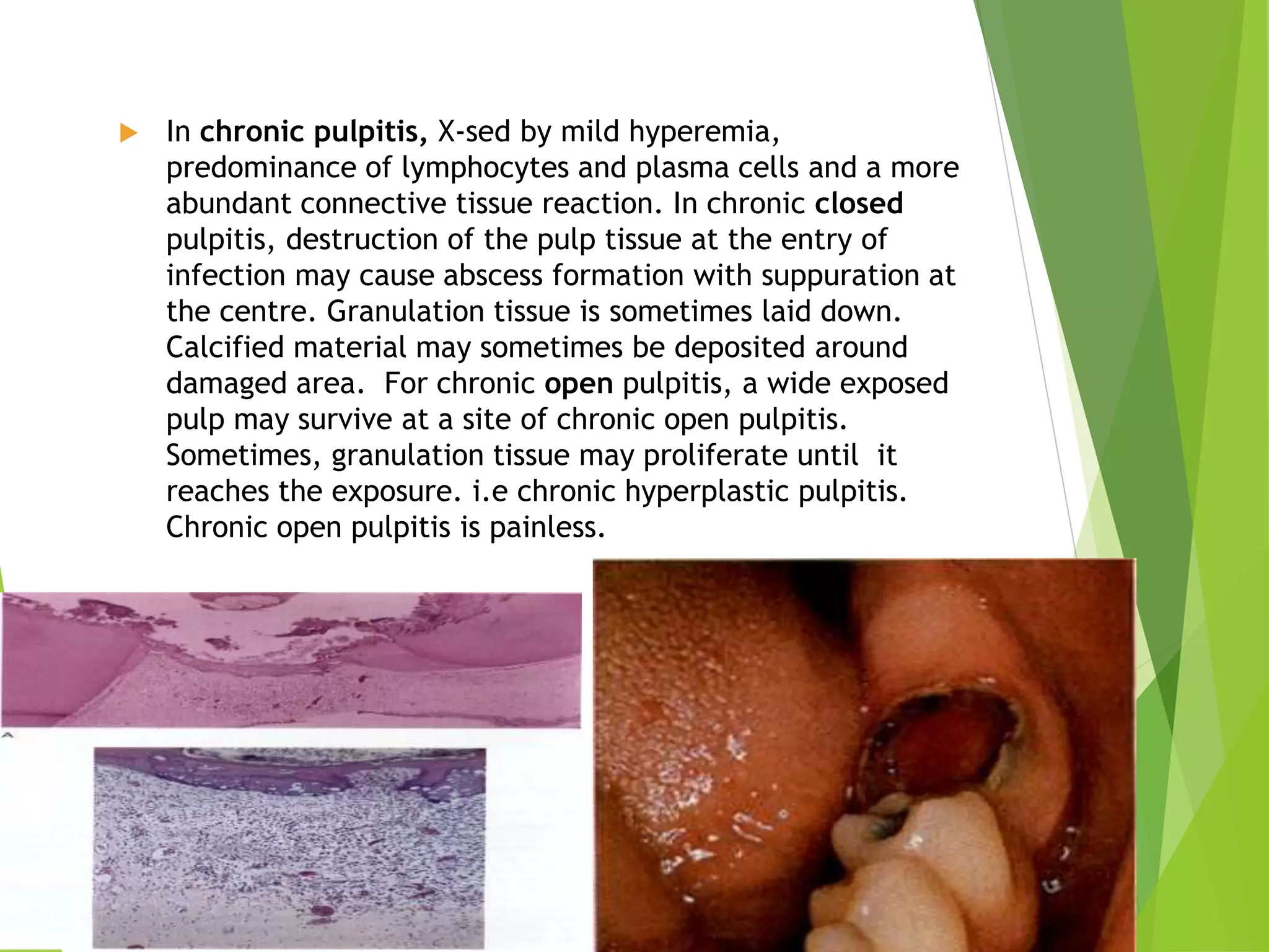 Dental caries sequelae | PPTX
