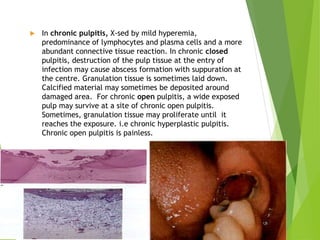 Dental caries sequelae | PPTX