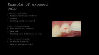 Dental case report on vital pulp therapy | PPTX