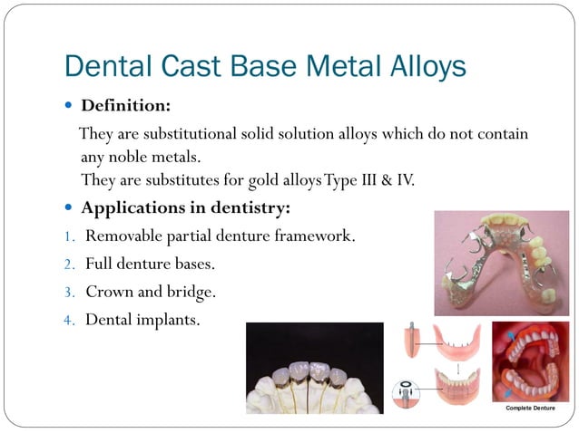 Dental casting alloys | PDF | Chemistry | Science