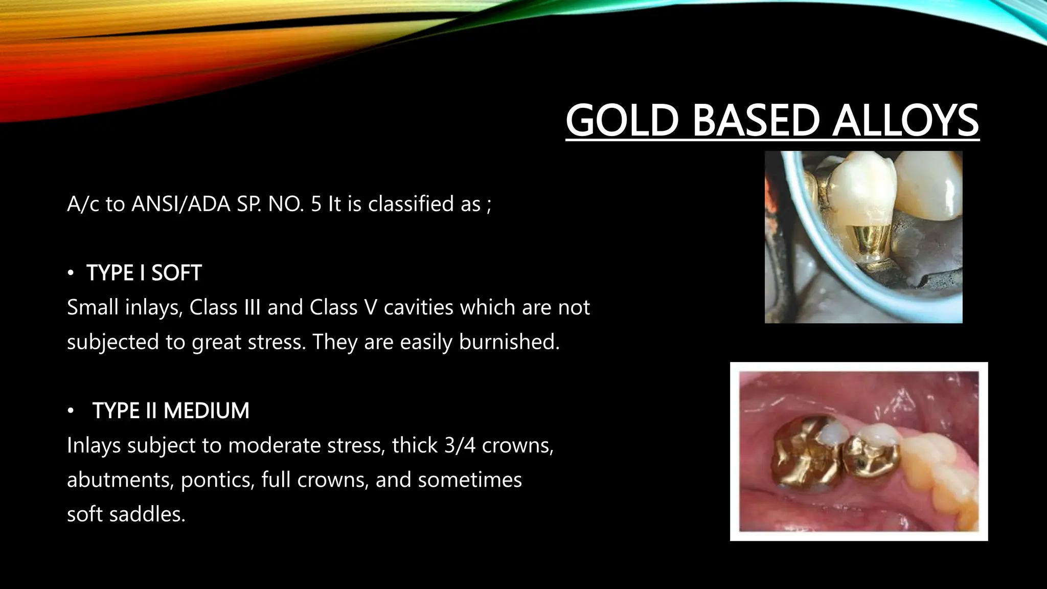 Dental casting alloys in prosthodontics crown bridge and implant | PPTX