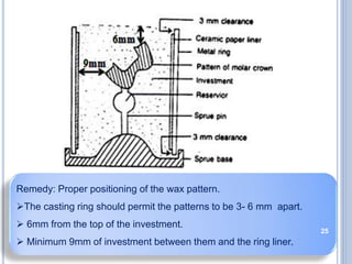 Dental_casting_defects.pptx PRESENTATION | PPTX