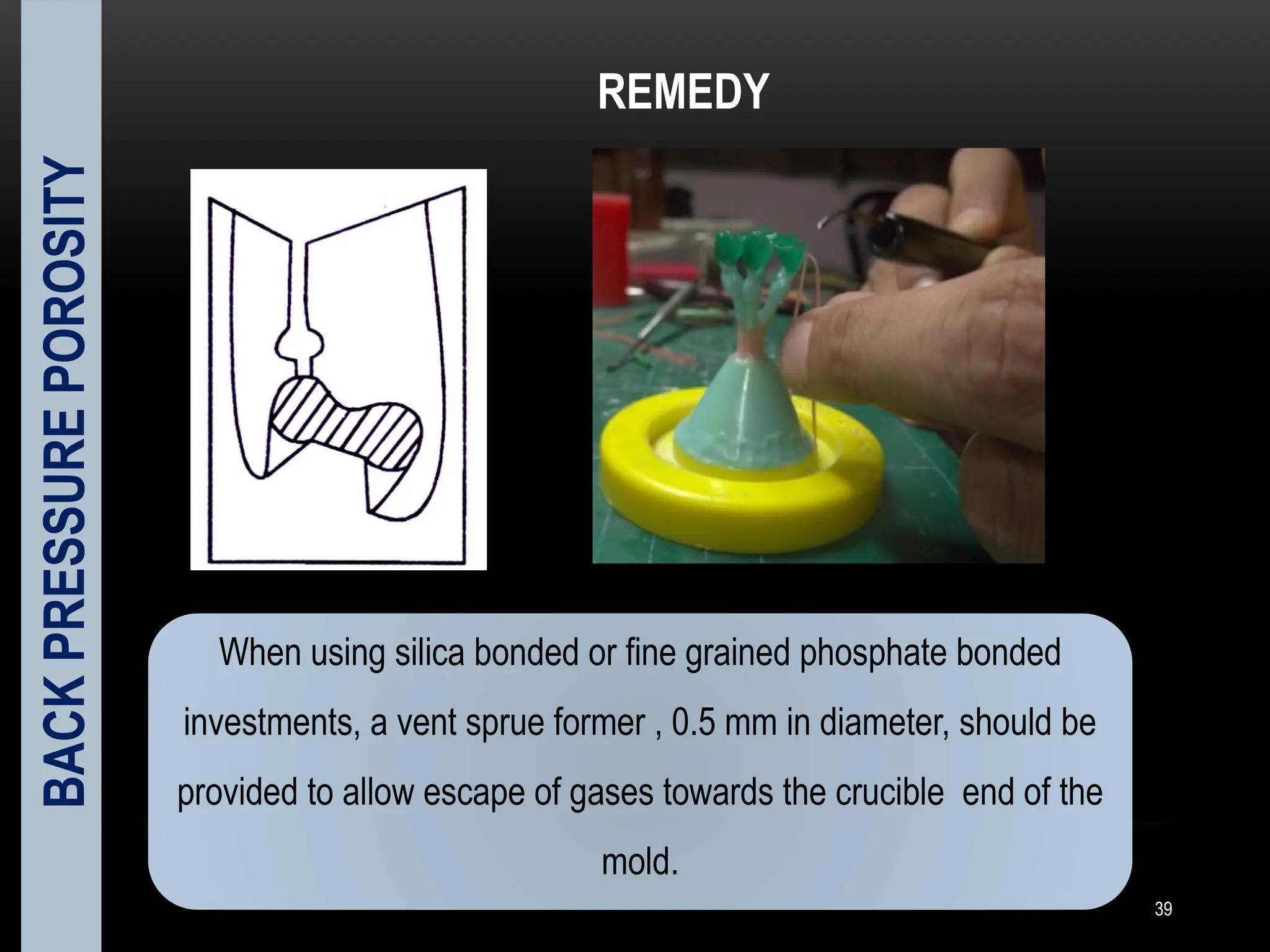 Dental_casting_defects power point presentation | PPTX