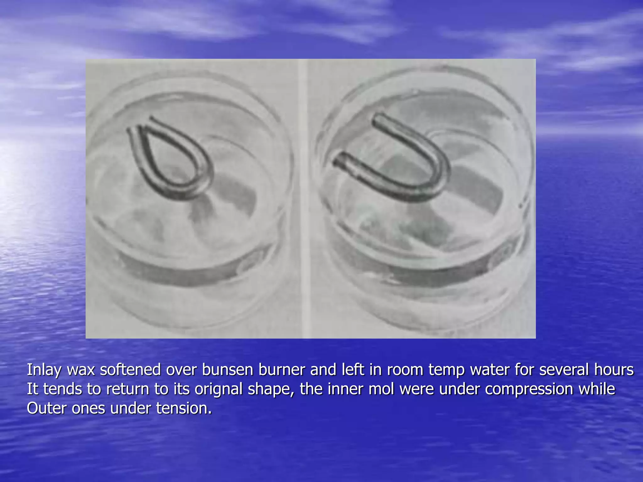 Dental casting waxes - Dr Aliya | PPT