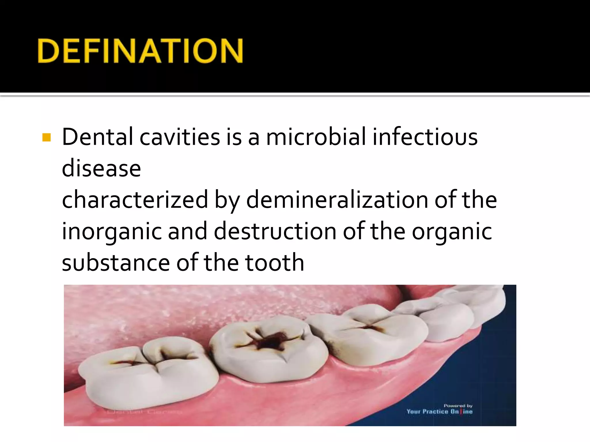 Dental cavities,bleeding gum,sensitivity mouth odour | PPTX