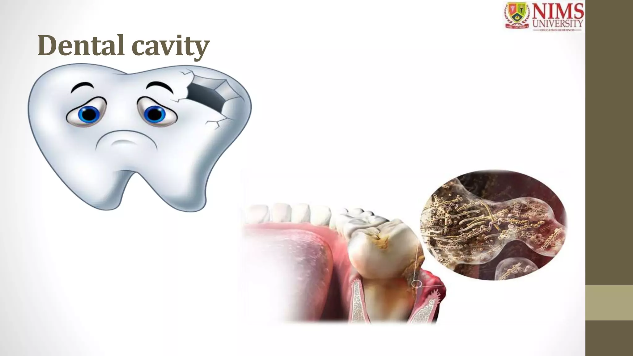 Dental Cavities , Gum , Bleeding ,Mouth.pptx