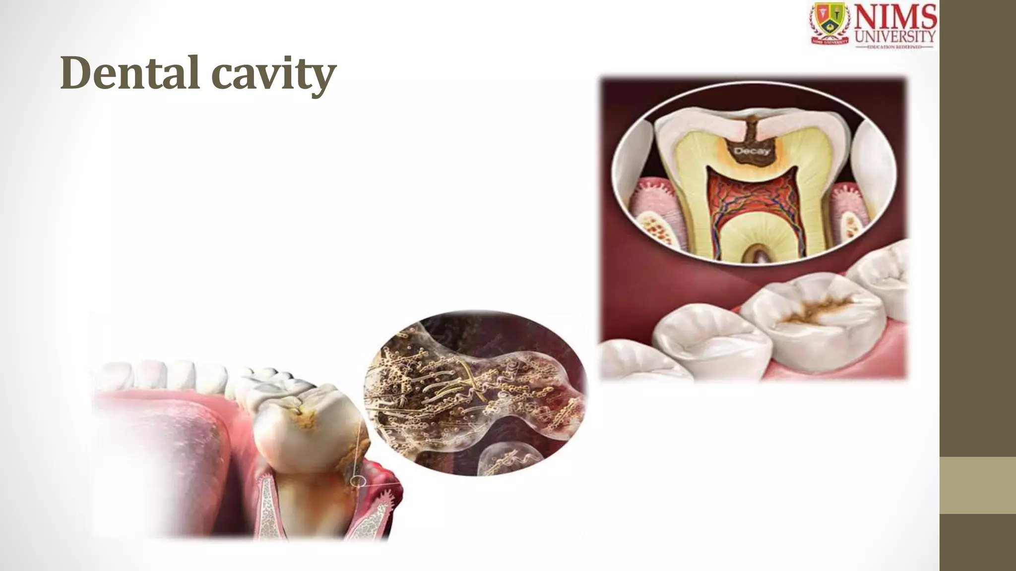 Dental Cavities , Gum , Bleeding ,Mouth.pptx