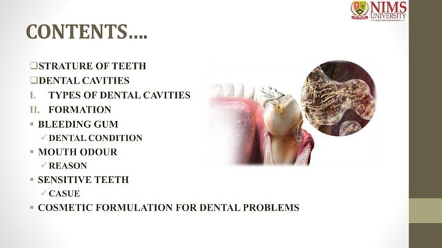 Dental Cavities , Gum , Bleeding ,Mouth.pptx | Oral care | Personal Care
