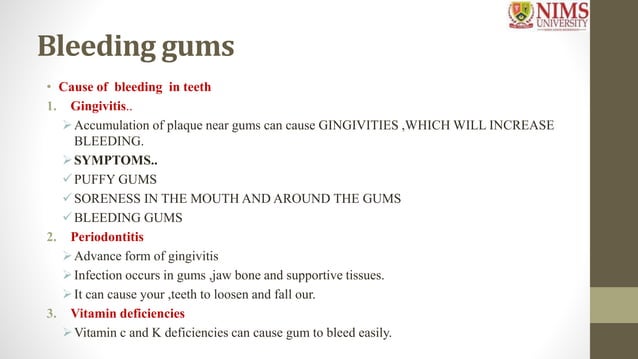 Dental Cavities , Gum , Bleeding ,Mouth.pptx | Oral care | Personal Care