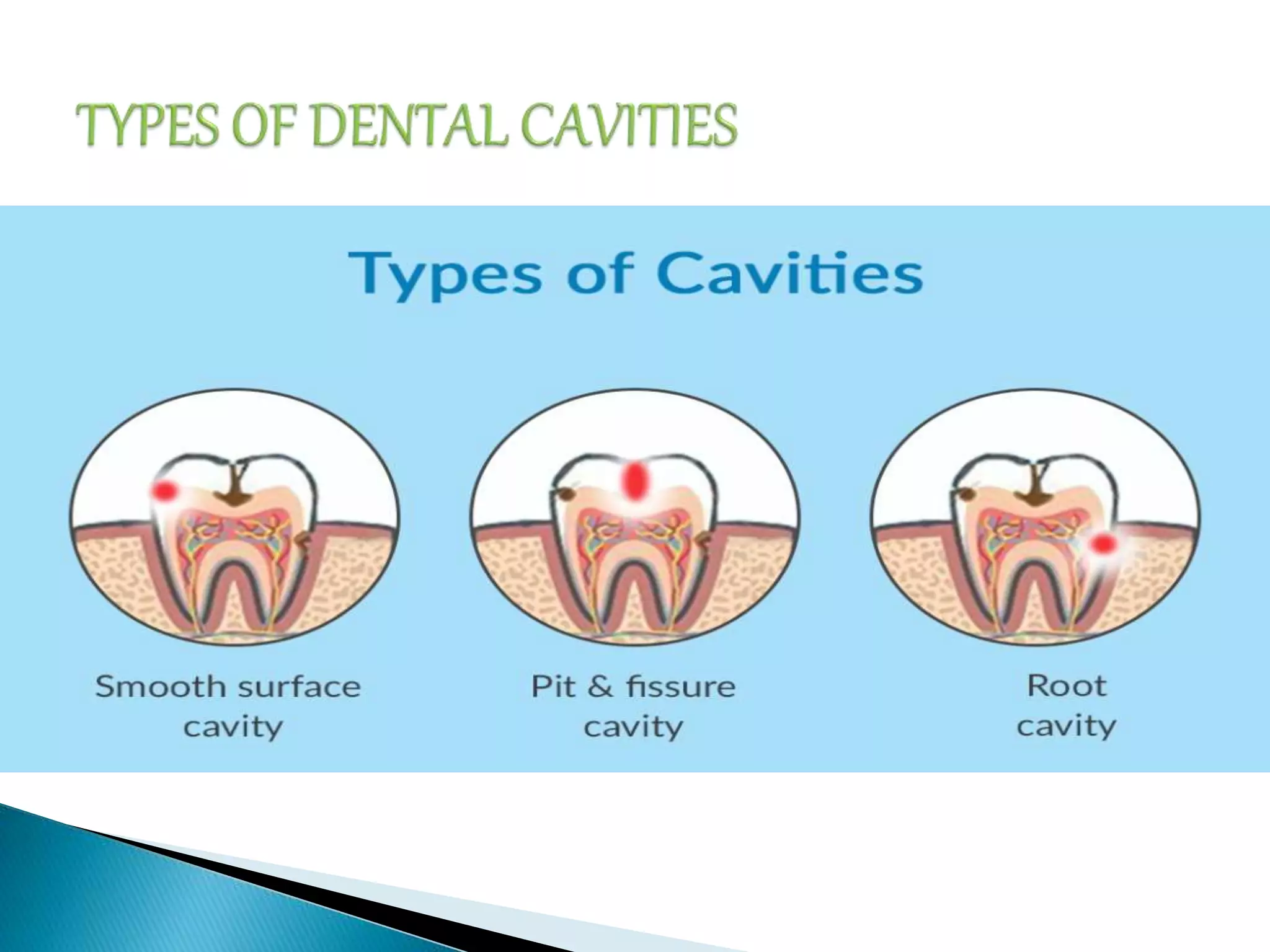Dental cavities,gum bleeding,mouth odour and sensitive teeth | PPTX