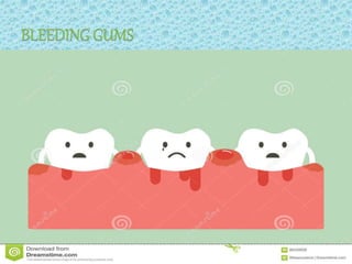 Dental cavities,gum bleeding,mouth odour and sensitive teeth | PPTX