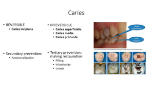 Dental cavity classification systems.PPTX