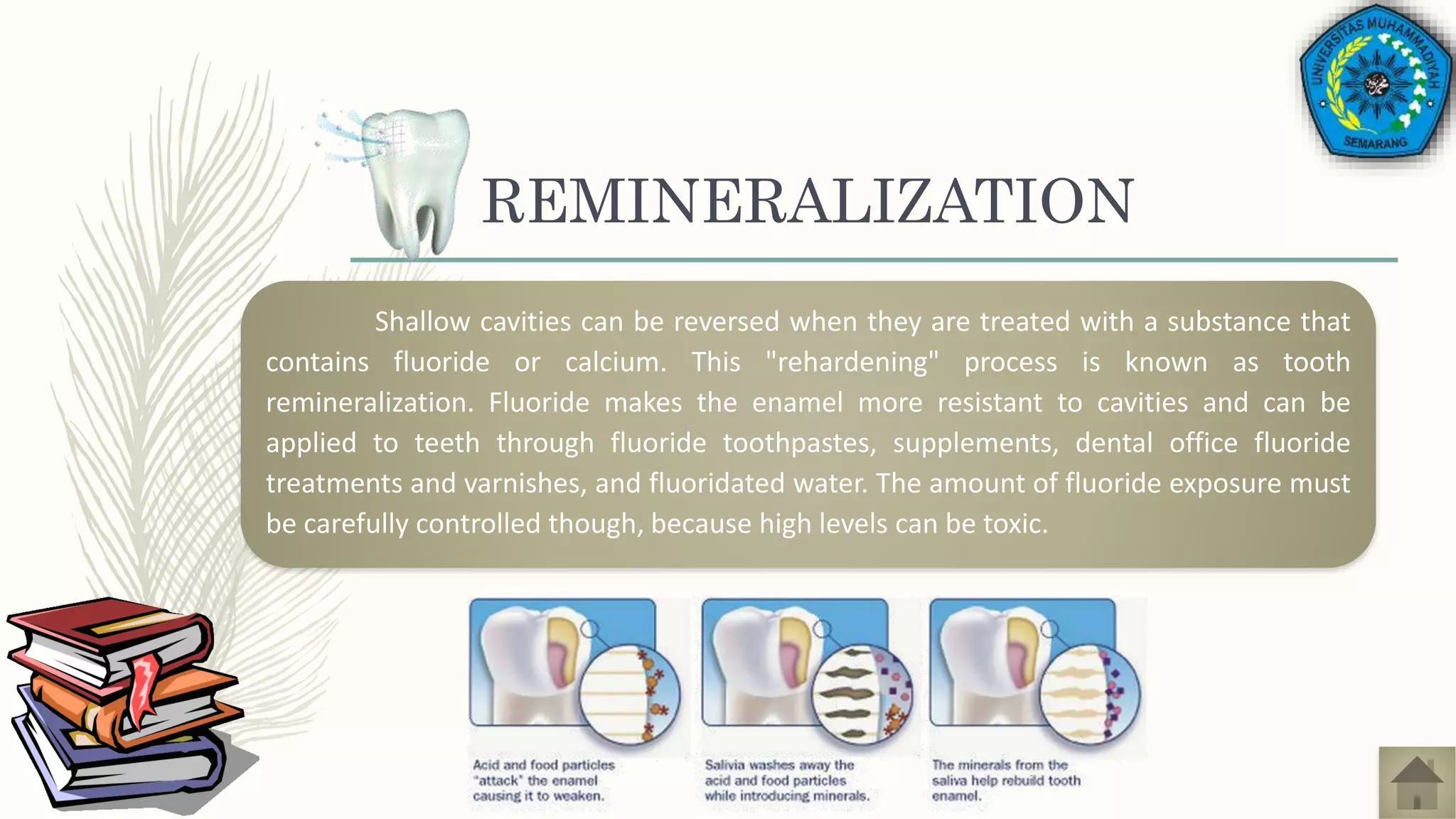Dental Cavity (Caries) | PPTX