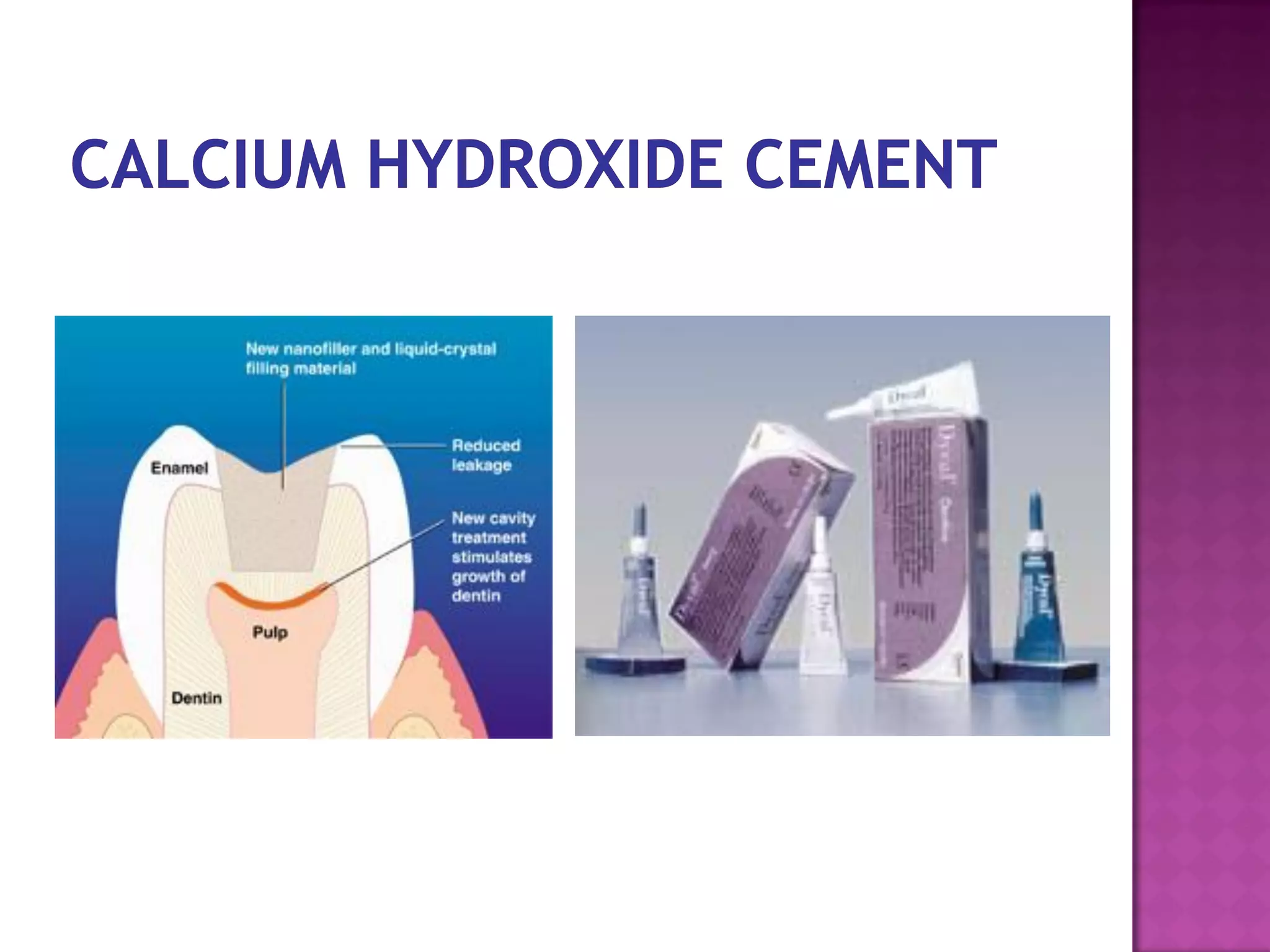 dental_cements.pdf