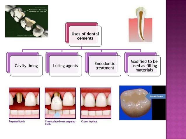 dental_cements.pdf