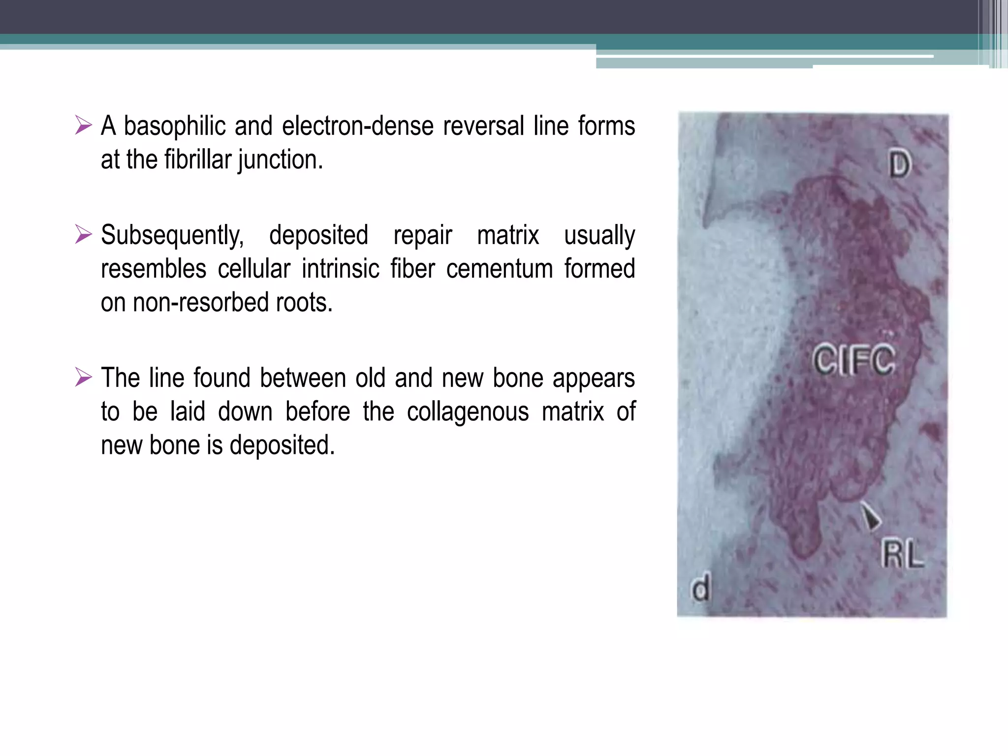 Dental cementum | PPTX