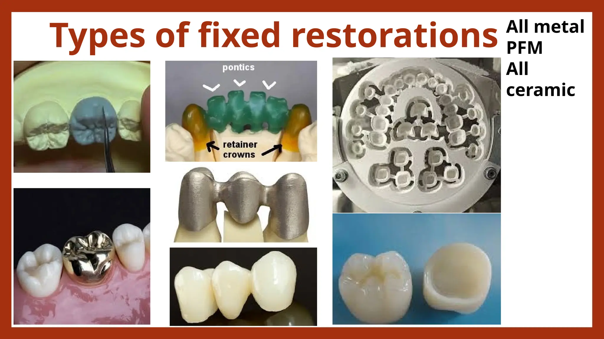 Dental Ceramics Part I - Dental Materials | PPTX