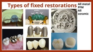 Dental Ceramics Part I - Dental Materials | PPT | Free Download