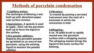 Dental Ceramics Part I - Dental Materials | PPT | Free Download