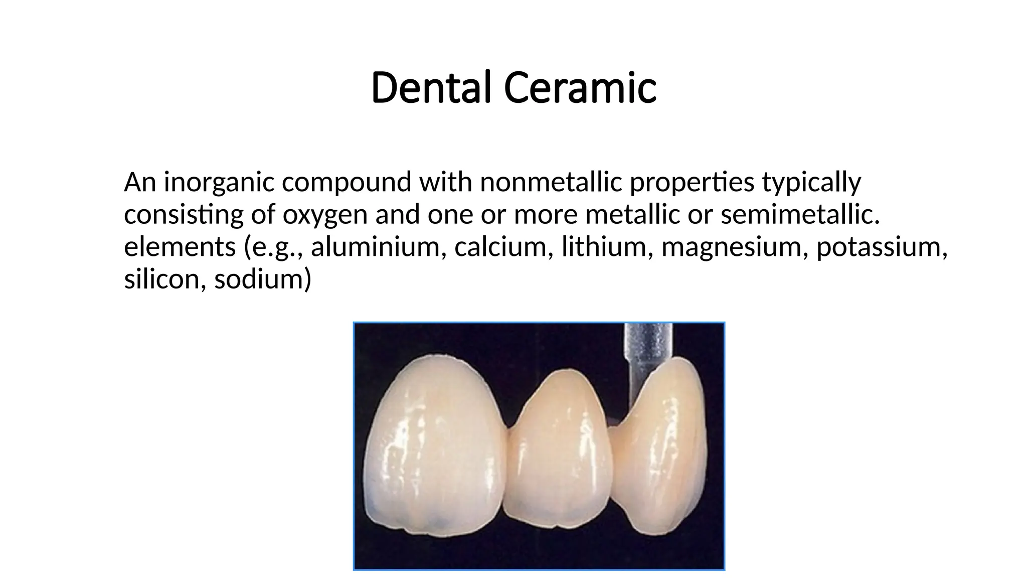 Role of dental ceramics in prosthodontics | PPTX