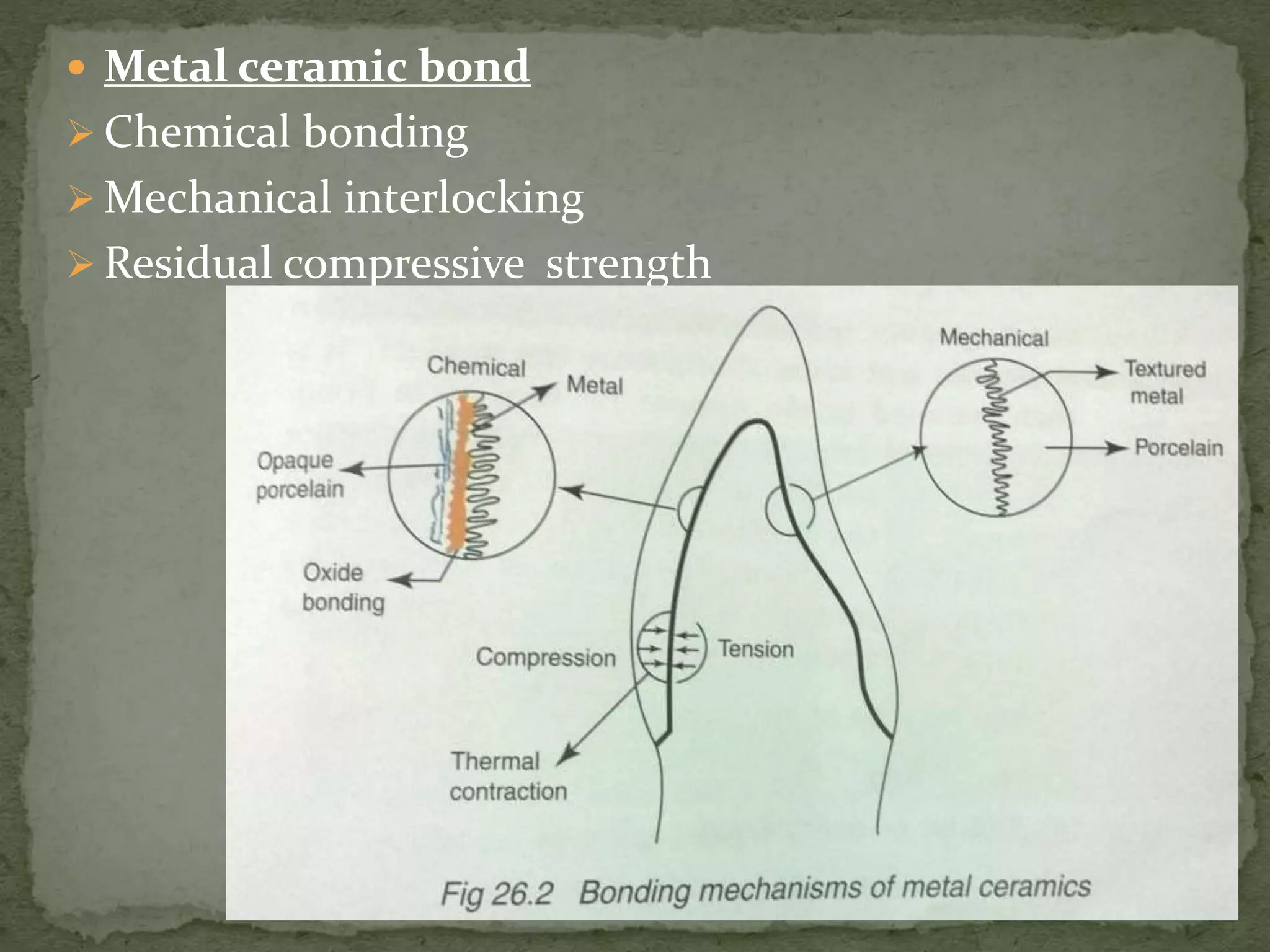 Dental Ceramic in Conservative Dentistry and Endodontics | PPTX