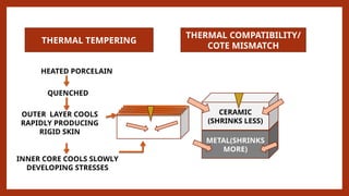Dental Ceramics Part II - Dental Materials | PPT